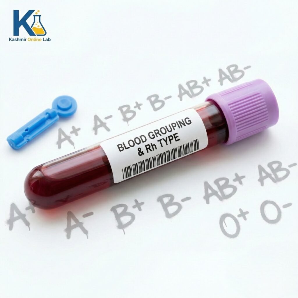 BLOOD GROUP & RH TYPE - Kashmir Online Laboratory